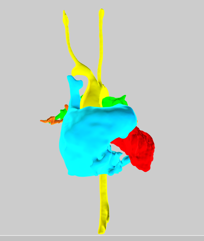 The Lynn & Arnold Irwin Advanced Perioperative Imaging Lab